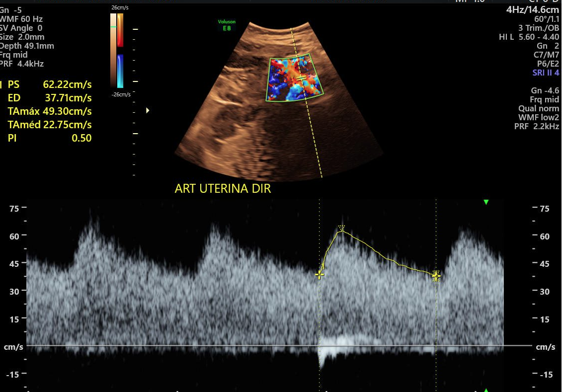 Belmed Ultrassom Obstétrico com Doppler - Clínica Belmed em Jundiaí